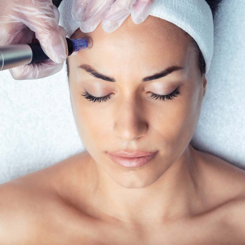 ANTI-AGEING FACIALS – The Wrinkleroom – Carmarthen