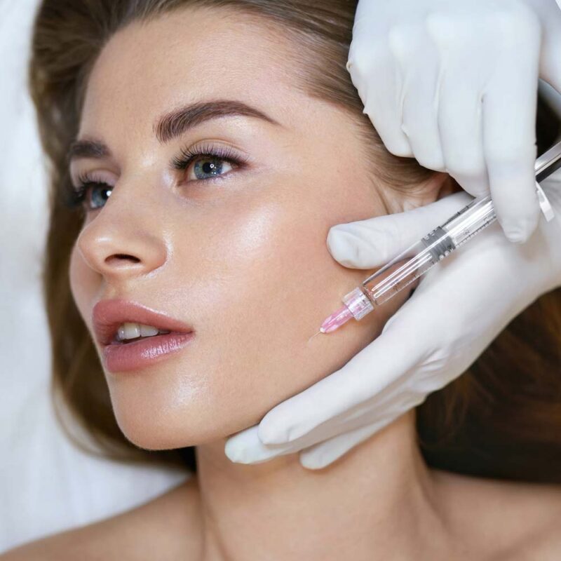 8 POINT FILLER FACELIFT – The Wrinkleroom – Carmarthen